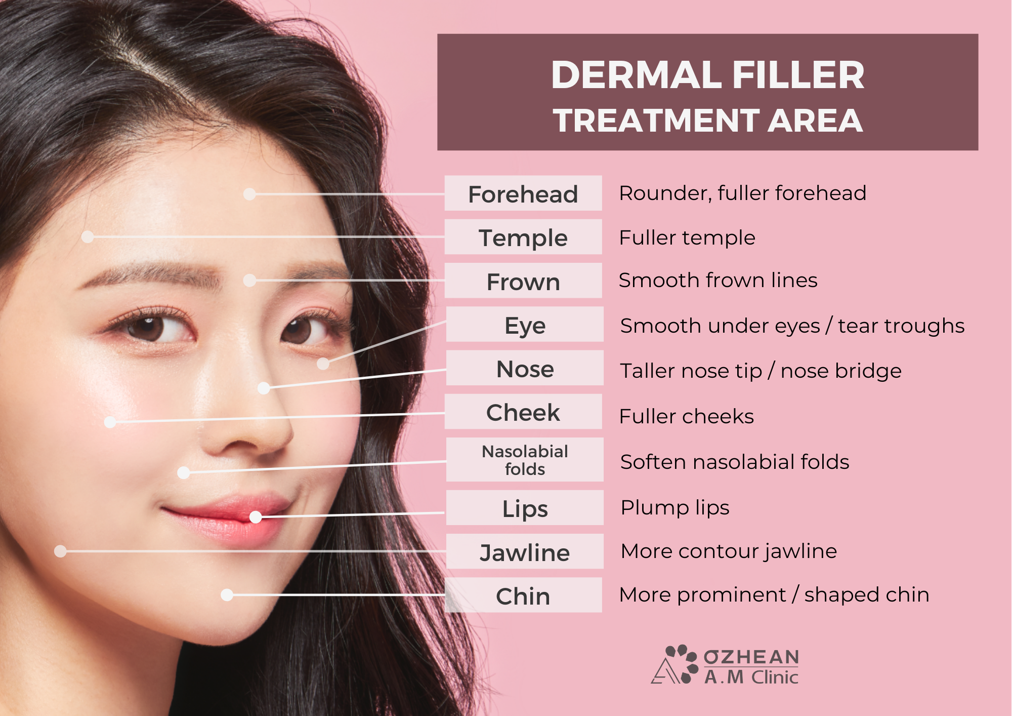 Filler (Part 1) – Hyaluronic Acid (HA) Filler - Ozhean