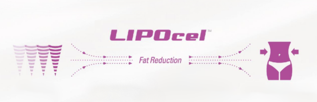 LIPOcel - High-Intensity Focused Ultrasound (HIFU) for Fat Reduction ...