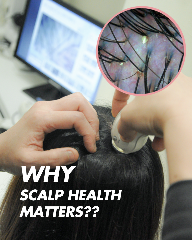 Scalp Health 101: The Key to Stronger, Healthier Hair